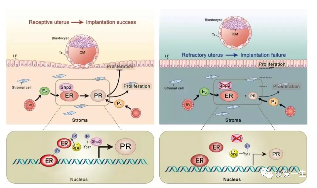 更方便+更强效竟然真实存在？全球首款口服SERD对晚期乳癌PFS改善，显著强于标准内分泌疗法!-咚咚肿瘤科