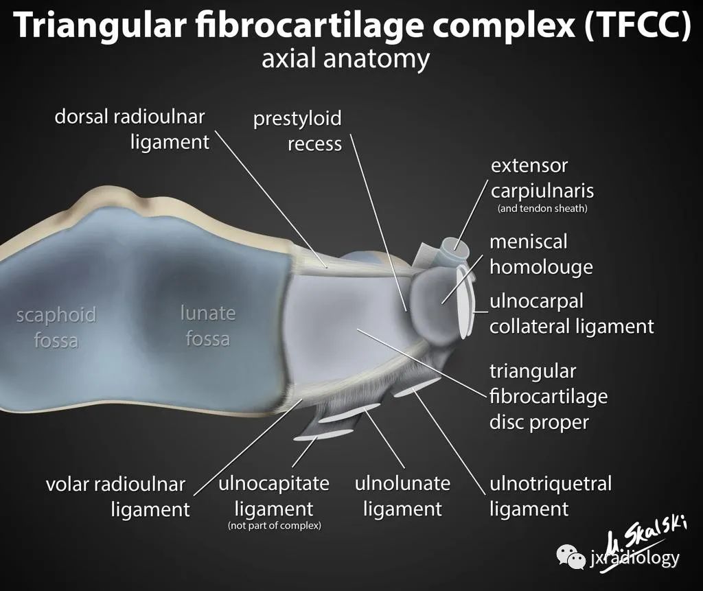 非创伤性腕关节疼痛MRI解读，本文告诉你详细答案！