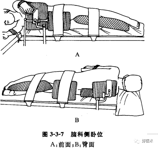 最佳“体位”那些事，关键内幕大揭秘！ - 好医术早读文章 - 好医术-赋能医生守护生命
